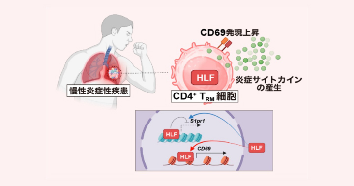 Hepatic leukemia factor directs tissue residency of proinflammatory ...